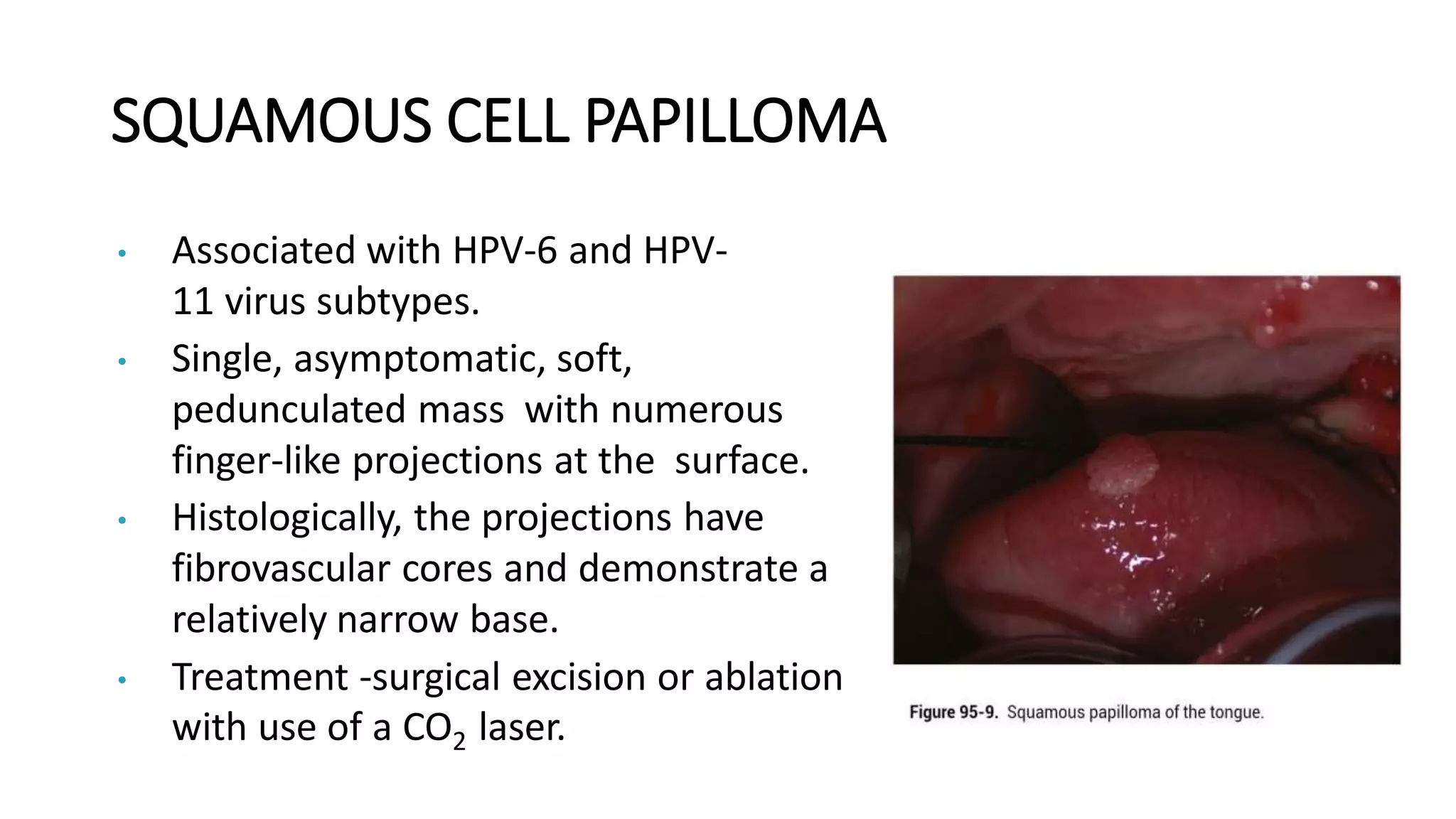 Benign Lesions of Oral Cavity.pptx