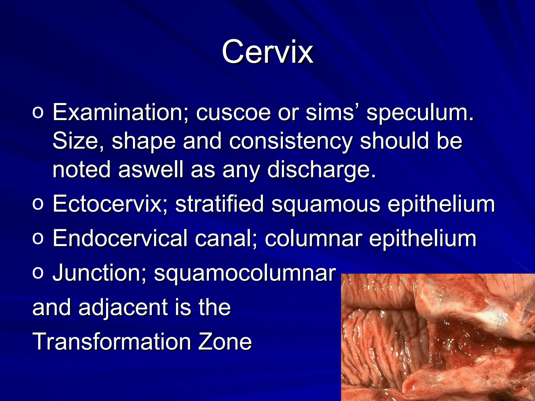 benignlesionsofthecervixvaginaandvulva-120205030502-phpapp02.ppt