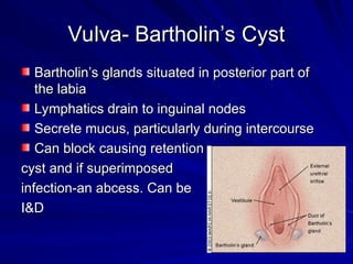 benignlesionsofthecervixvaginaandvulva-120205030502-phpapp02.ppt