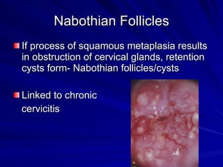 Benign lesions of the cervix, vagina and vulva | PPT