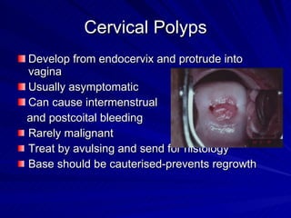 Vaginal Wall Polyps