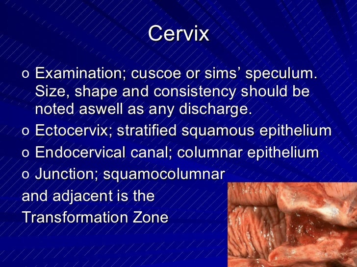 Benign Lesions Of The Cervix Vagina And Vulva