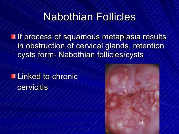 Benign lesions of the cervix, vagina and vulva