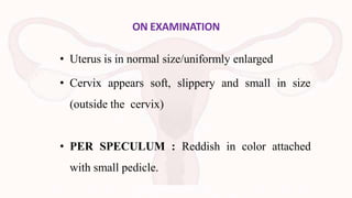 Benign lesions of uterus | PPTX