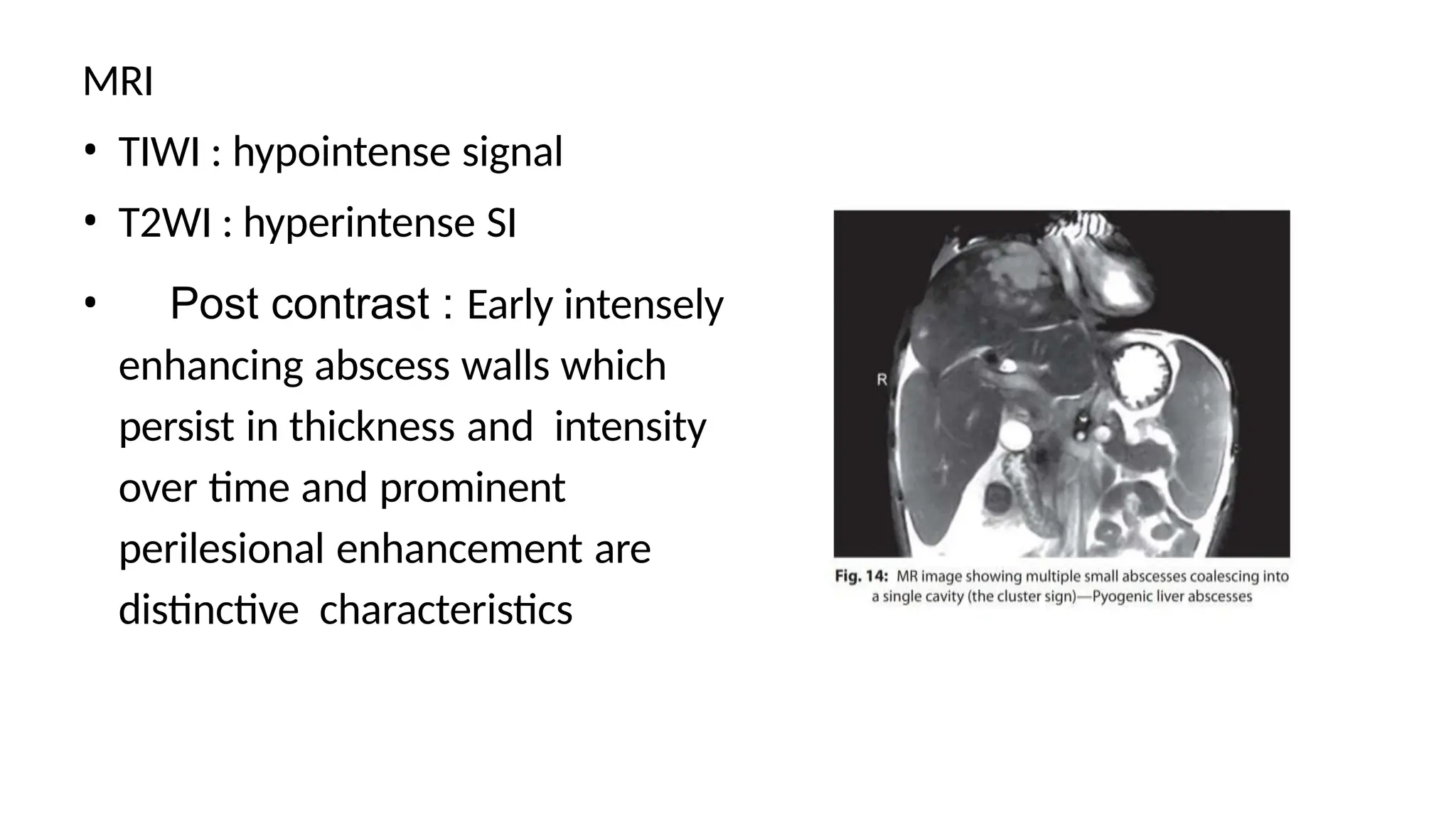 benign liver (focal and diffuse )leisons 1.pptx