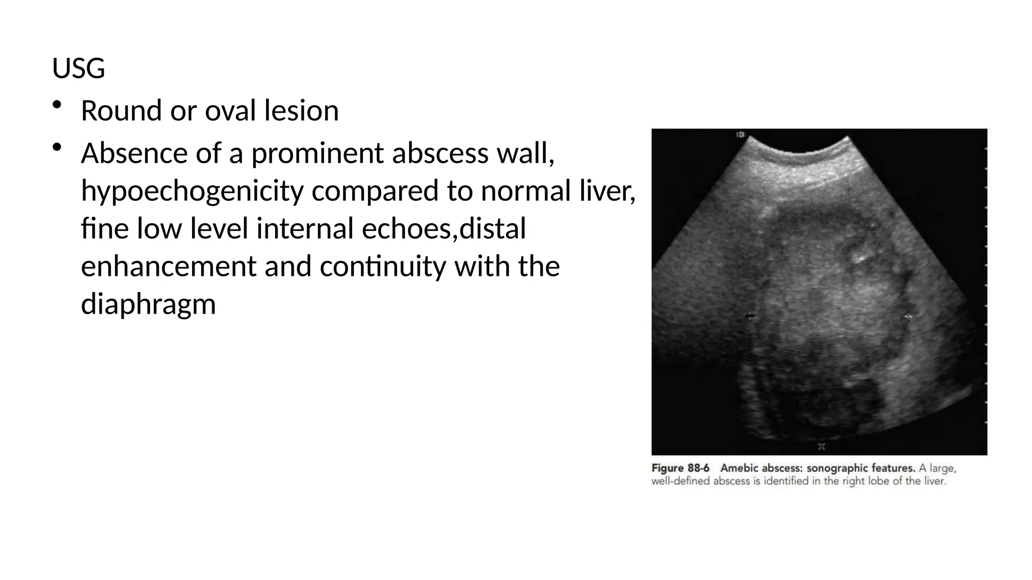 benign liver (focal and diffuse )leisons 1.pptx