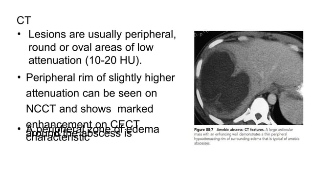 benign liver (focal and diffuse )leisons 1.pptx