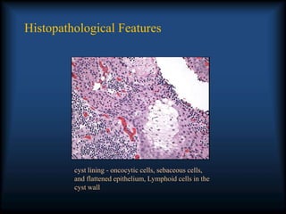 Benign lymphoepithelial-03.ppt lesions.. | PPT
