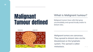 benign & mailgnant.pptx