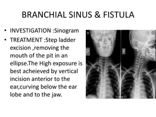 Benign neck mass | PPTX