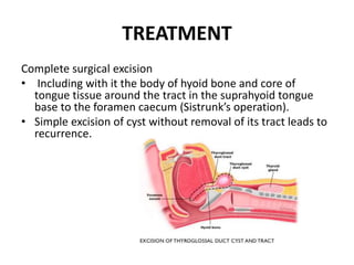 Benign neck mass | PPTX