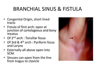 Congenital Pharyngocutaneous Fistula