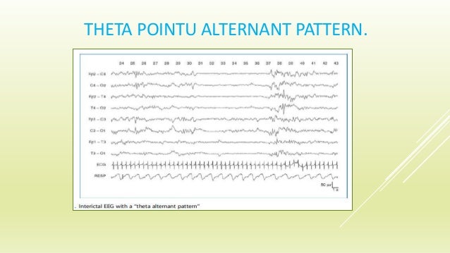 Benign neonatal and_infantile_ seizures_ Dr Santhosh Dash NIMHANS