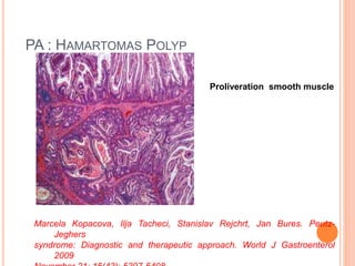 Benign Neoplasm of Colon and Rectum | PPTX