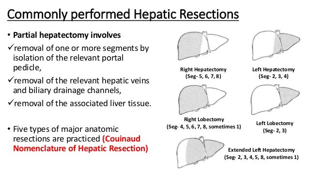 Benign neoplasms of liver