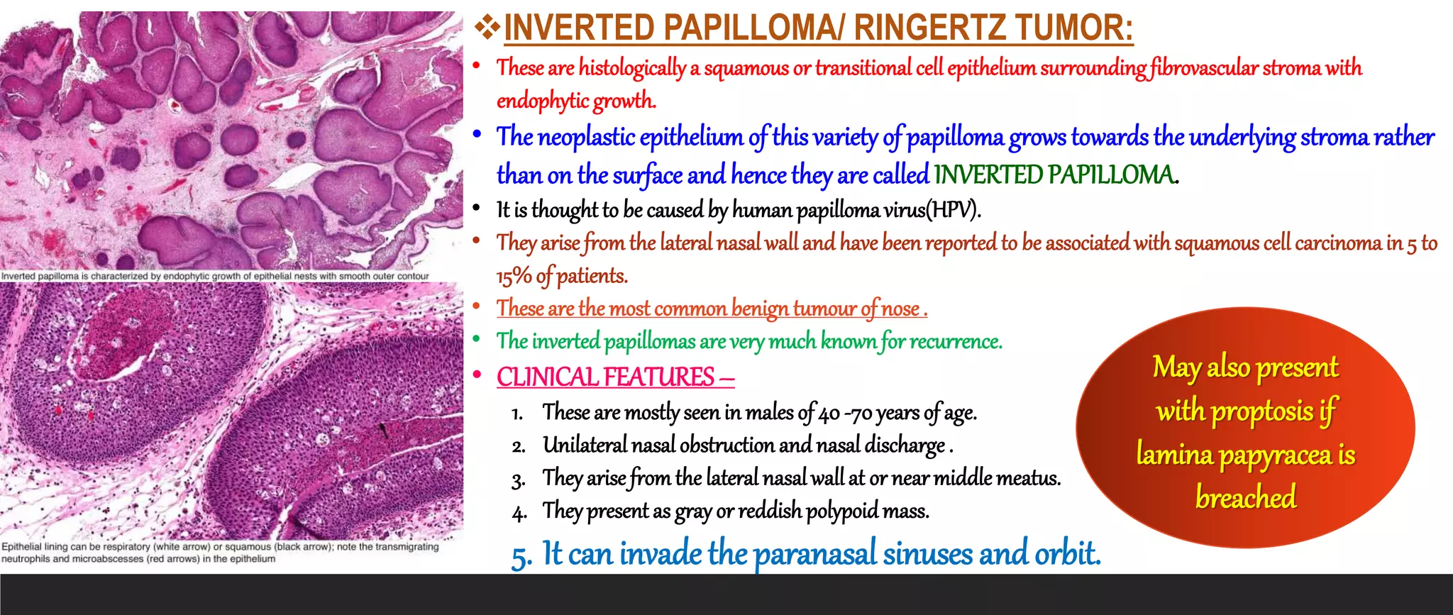 BENIGN NEOPLASMS OF THE NOSE AND PNS.pptx