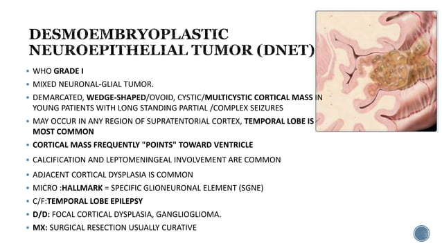 Benign neoplastic lesions of brain | PPT