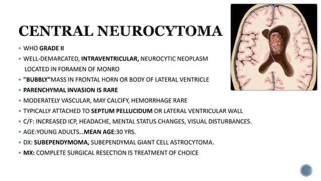 Benign neoplastic lesions of brain | PPT