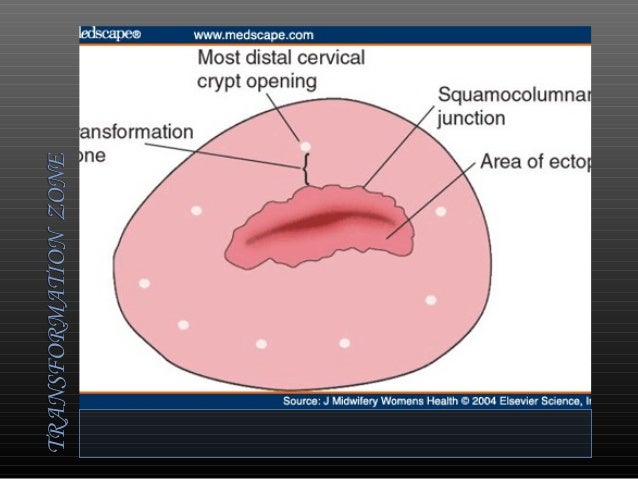 Benign n pre malignant diseases of cx