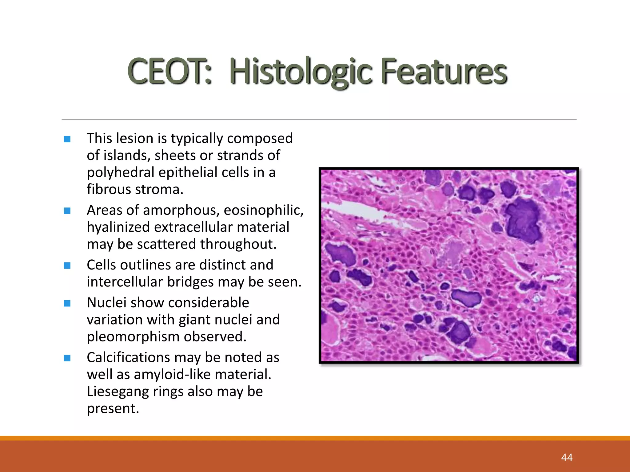 Benign odontogenic and non odontogenic tumours | PPTX