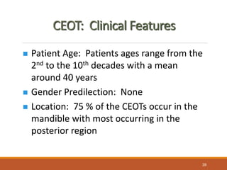 Benign odontogenic and non odontogenic tumours | PPTX
