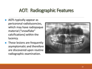 Benign odontogenic and non odontogenic tumours | PPTX