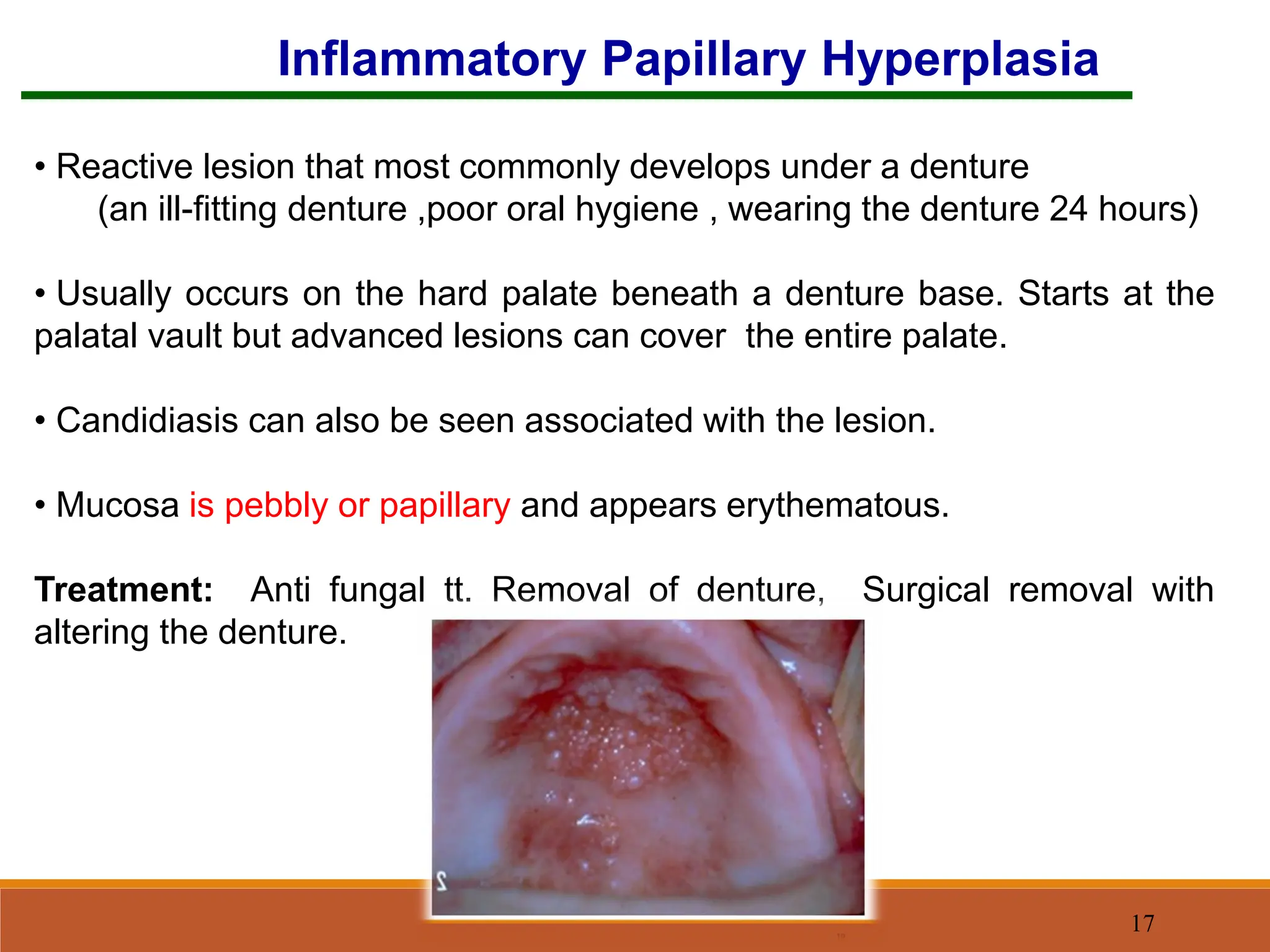 Benign oral lesions and normal deferential - .pdf