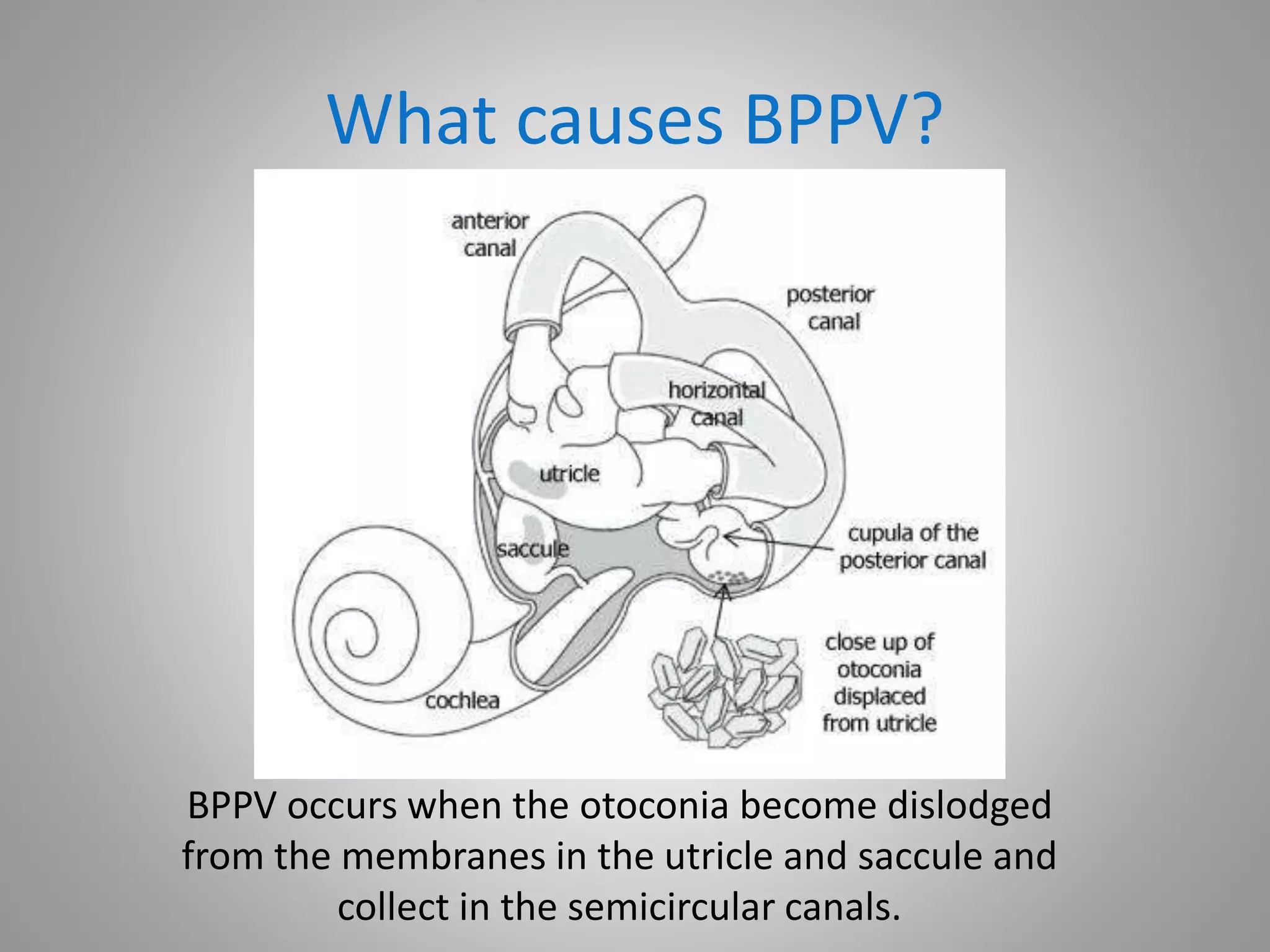 Benign Paroxysmal Positional Vertigo (BPPV) | PPTX | Ear, Nose and Throat Conditions | Diseases ...