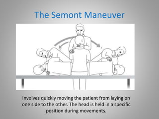 Benign Paroxysmal Positional Vertigo (BPPV) | PPT