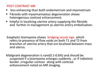 Benign pelvic diseases in females 2 | PPTX
