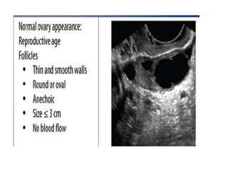 Benign pelvic diseases in females 2 | PPTX