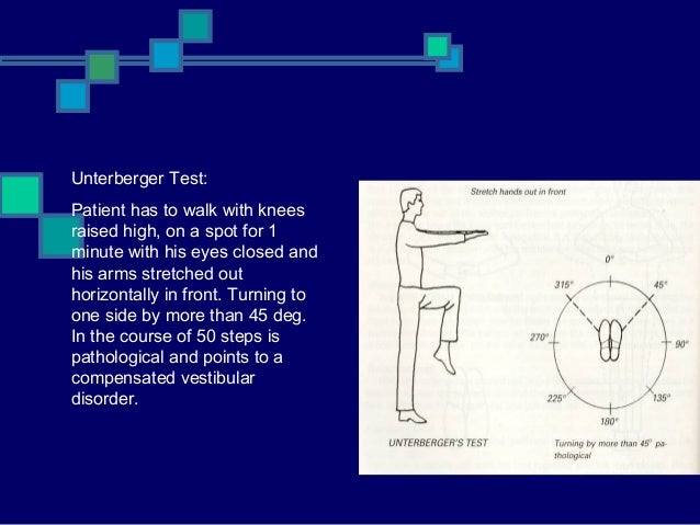 Benign positional vertigo