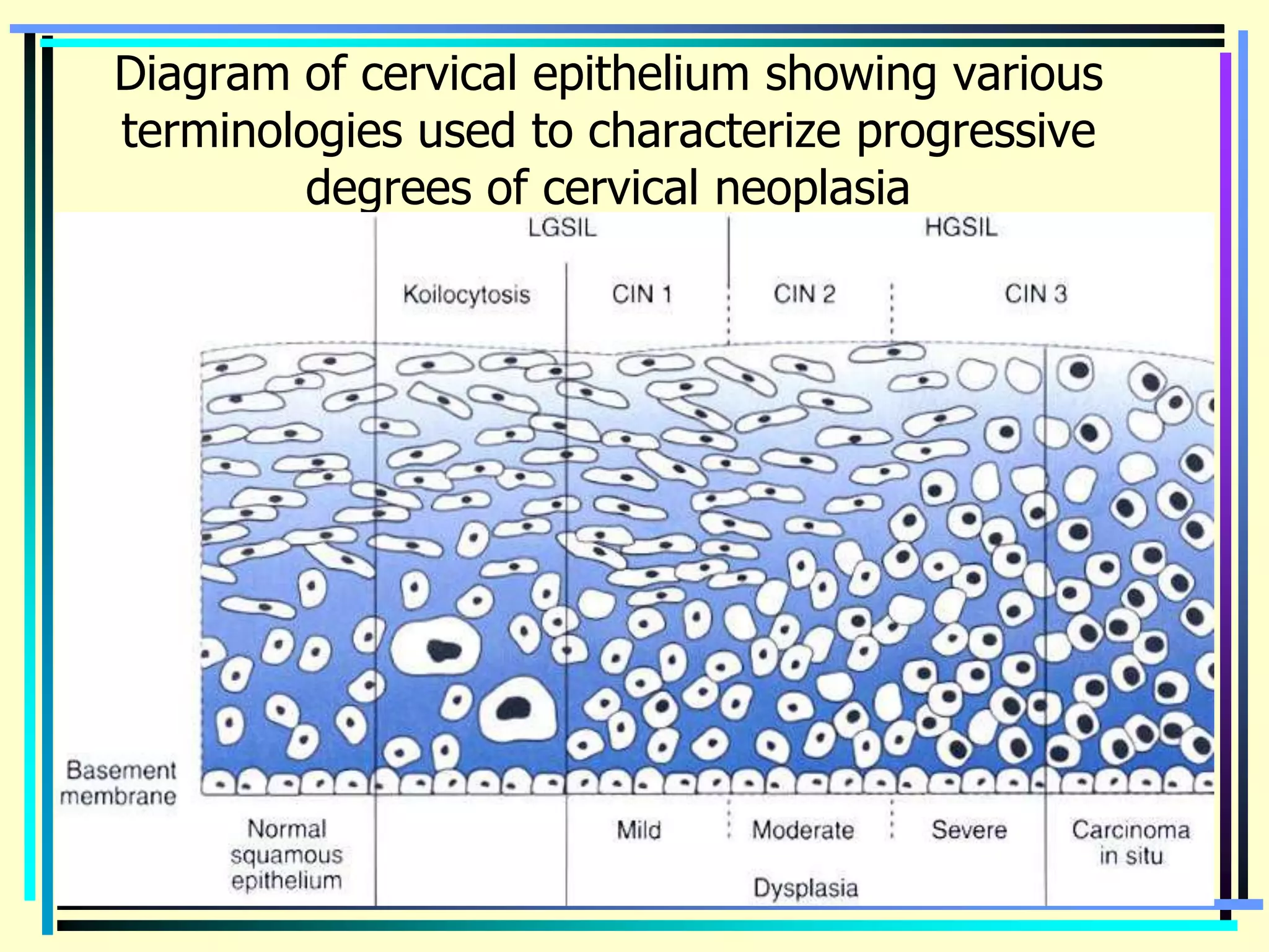 Benign & precancerous tumors of female genital organs | PPTX