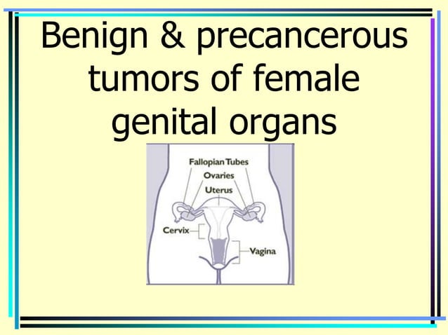 Benign & precancerous tumors of female genital organs | PPTX