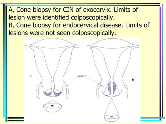 Benign & precancerous tumors of female genital organs | PPTX