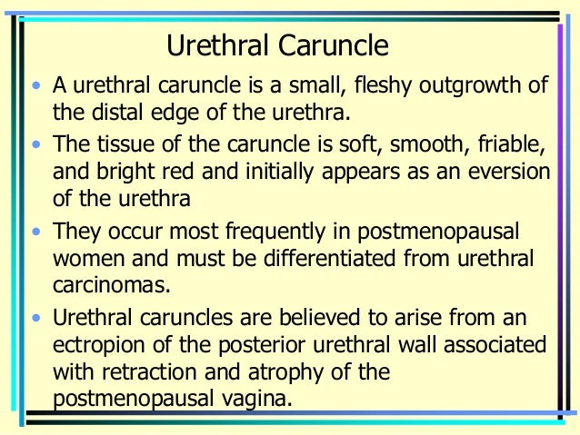 Benign & precancerous tumors of female genital organs