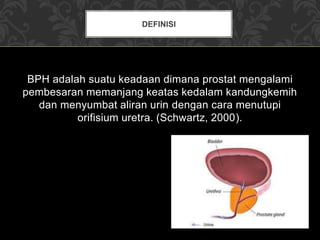 Benign prostate hyperplasia | PPT