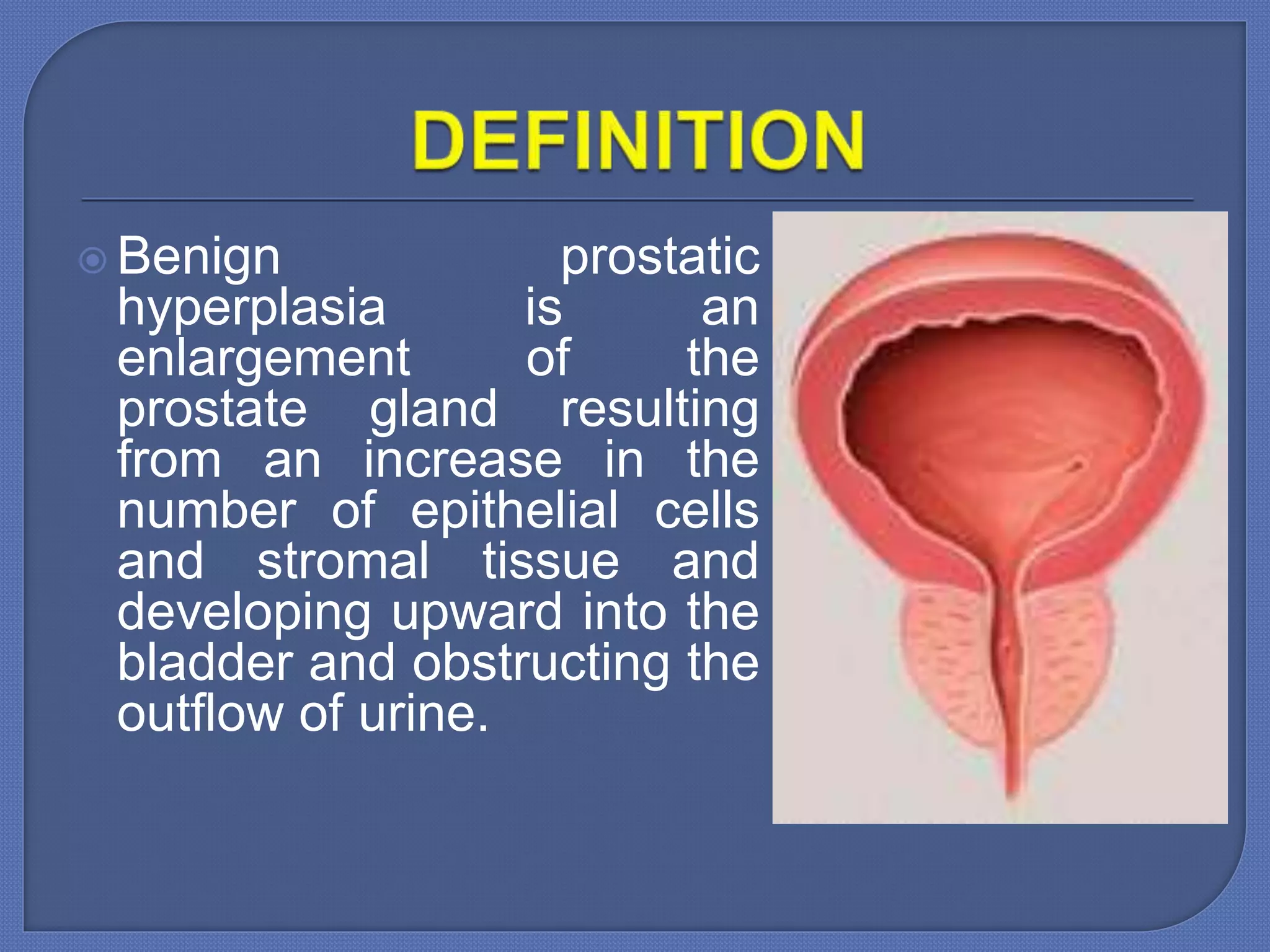 Benign prostate hyperplasia (BPH) | PPTX