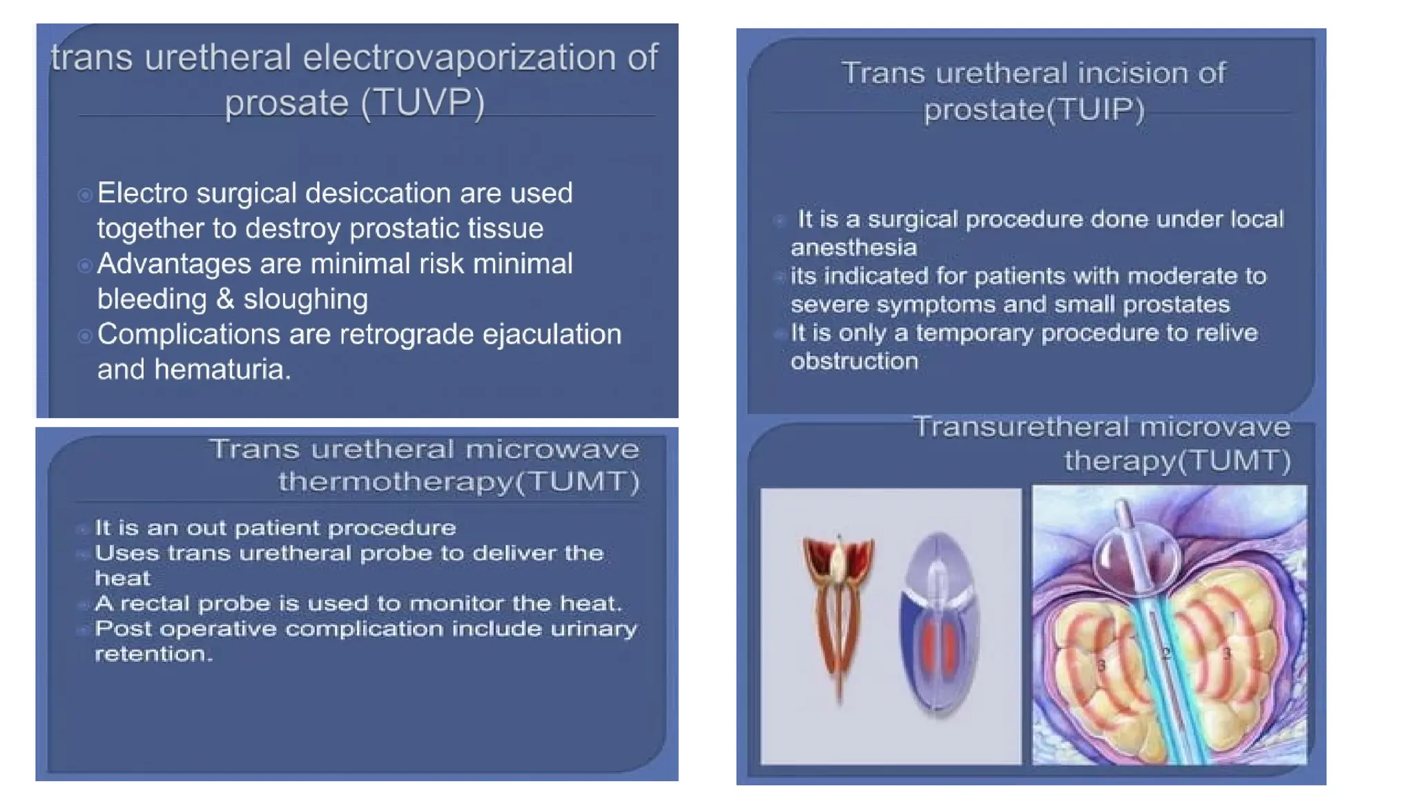 Benign Prostate Hyperplasia for nurses ppt | PPT