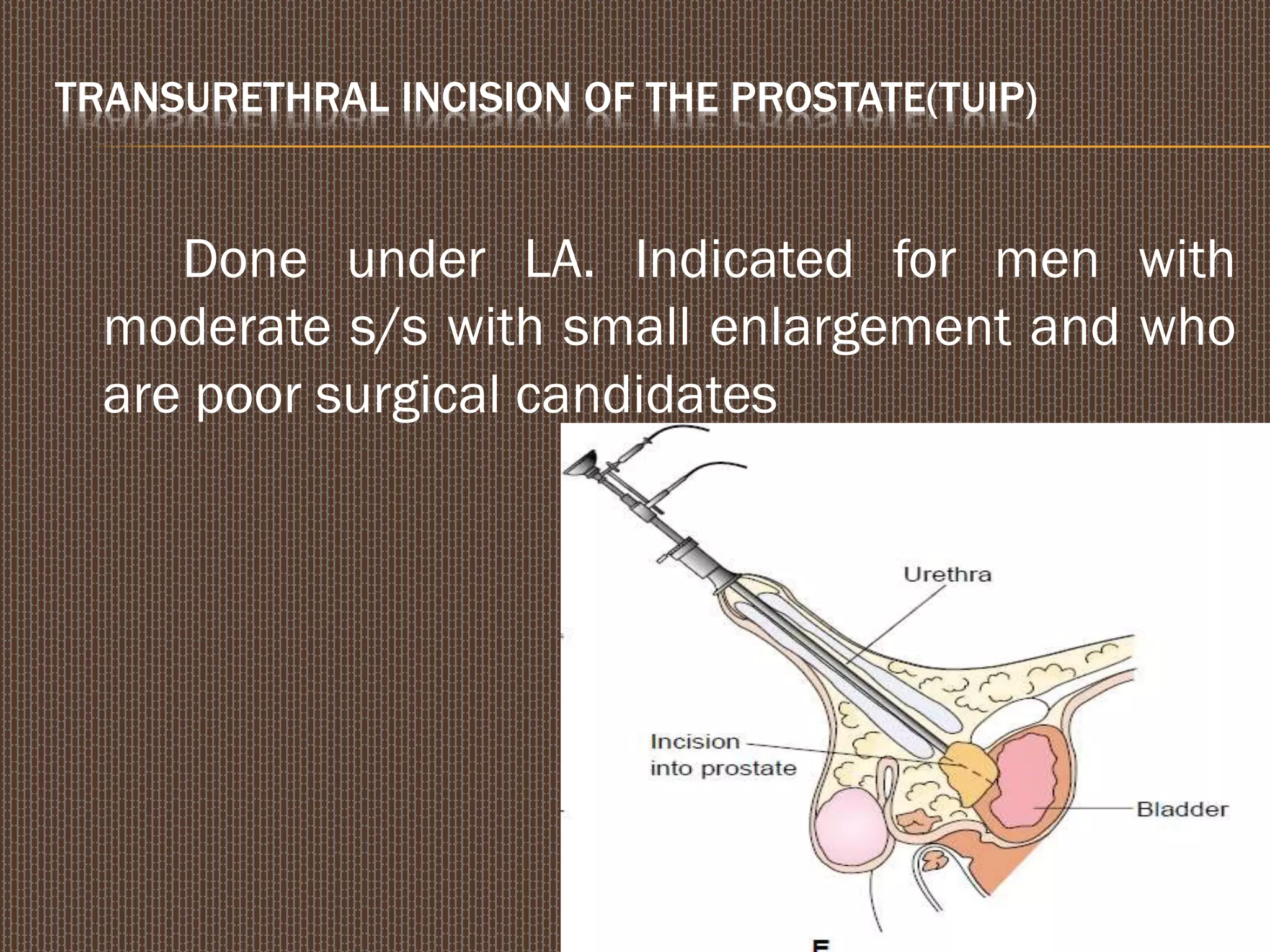 Benign Prostate Hypertrophy for nursing students | PPTX