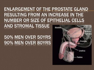 Benign Prostate Hypertrophy for nursing students | PPTX | Endocrine and ...