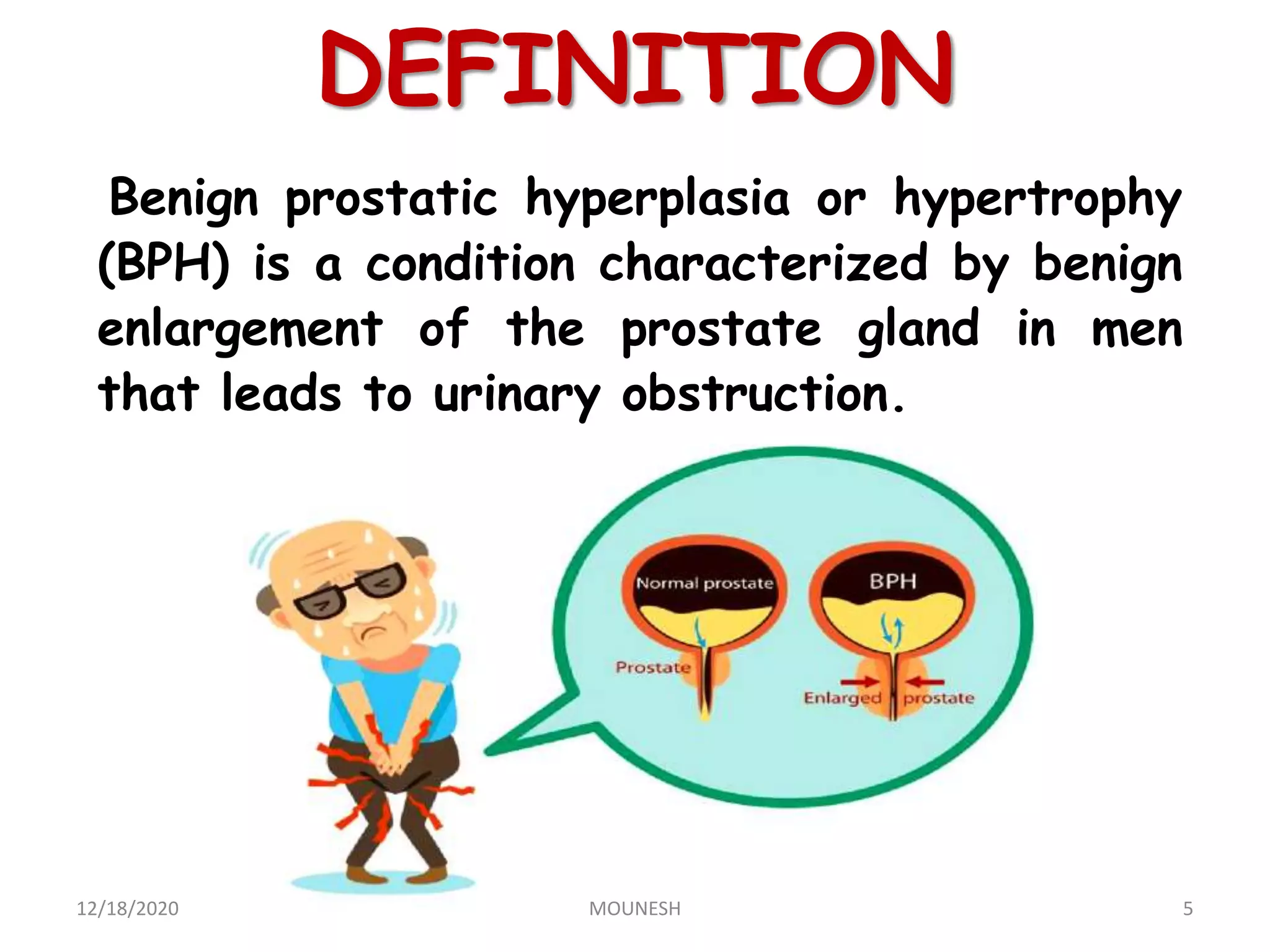 Benign prostate hypertrophy | PPTX