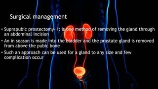 Benign prostate hypertrophy.pptx