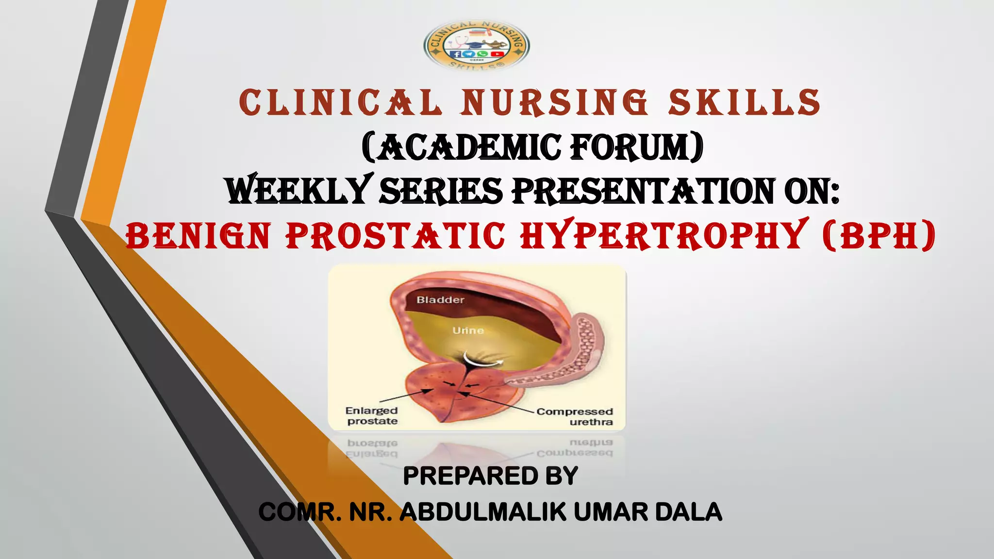 BENIGN PROSTATE HYPERTROPHY.pdf
