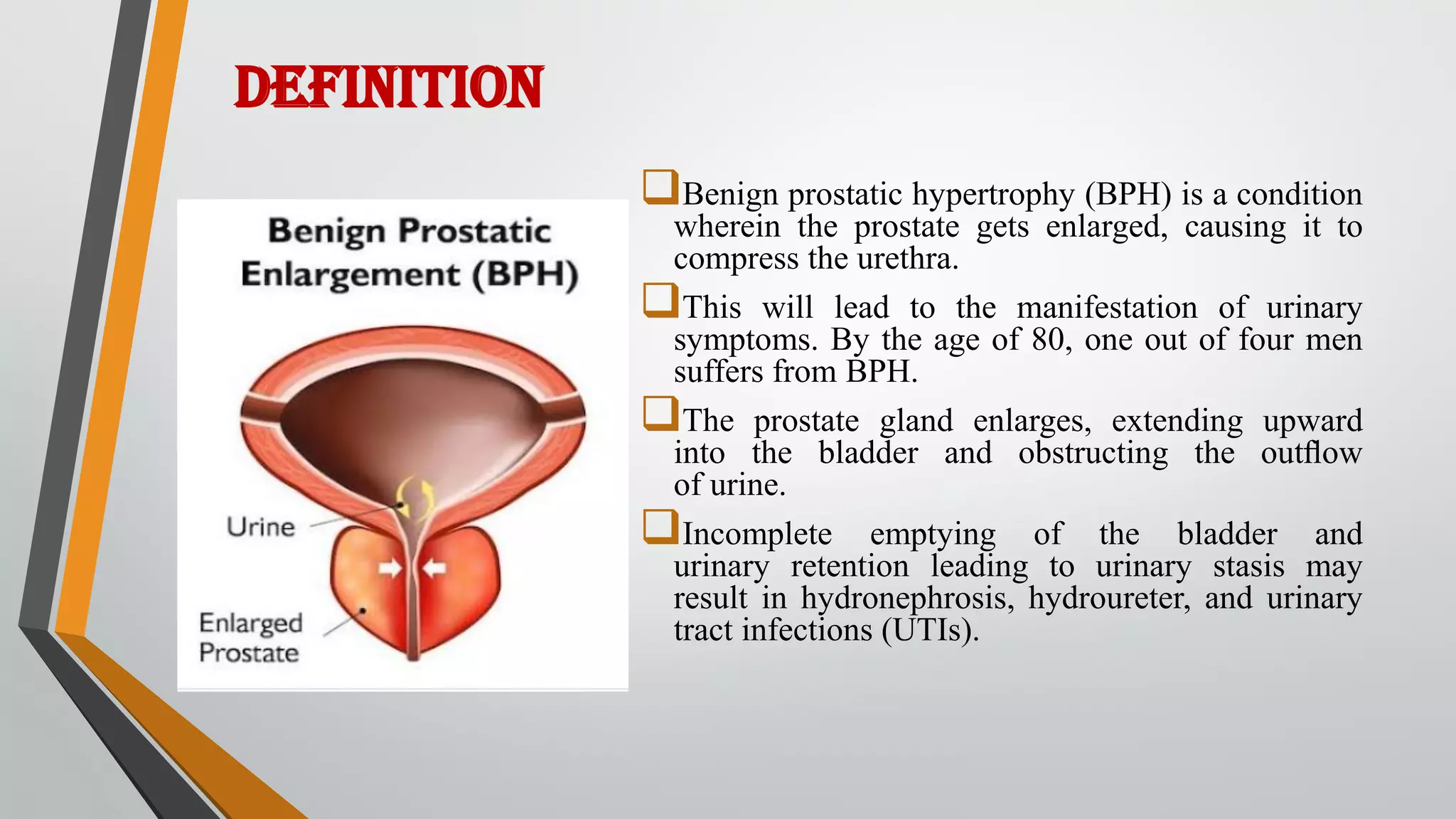 BENIGN PROSTATE HYPERTROPHY.pdf