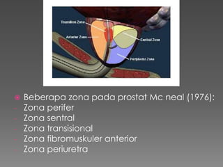 Benign prostat hiperplasia | PPTX