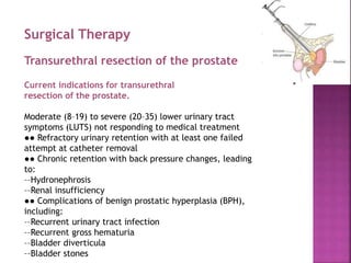 Benign prostatic hyperplasia | PPTX