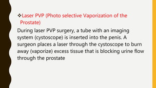 Benign prostatic enlargement | PPTX