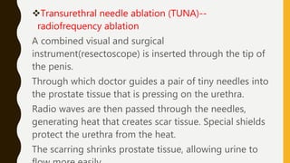 Benign prostatic enlargement | PPTX