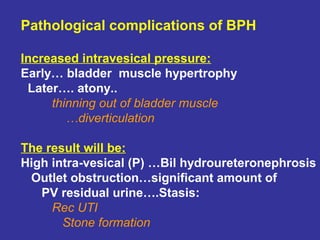 Benign prostatic hyperplasia | PPT